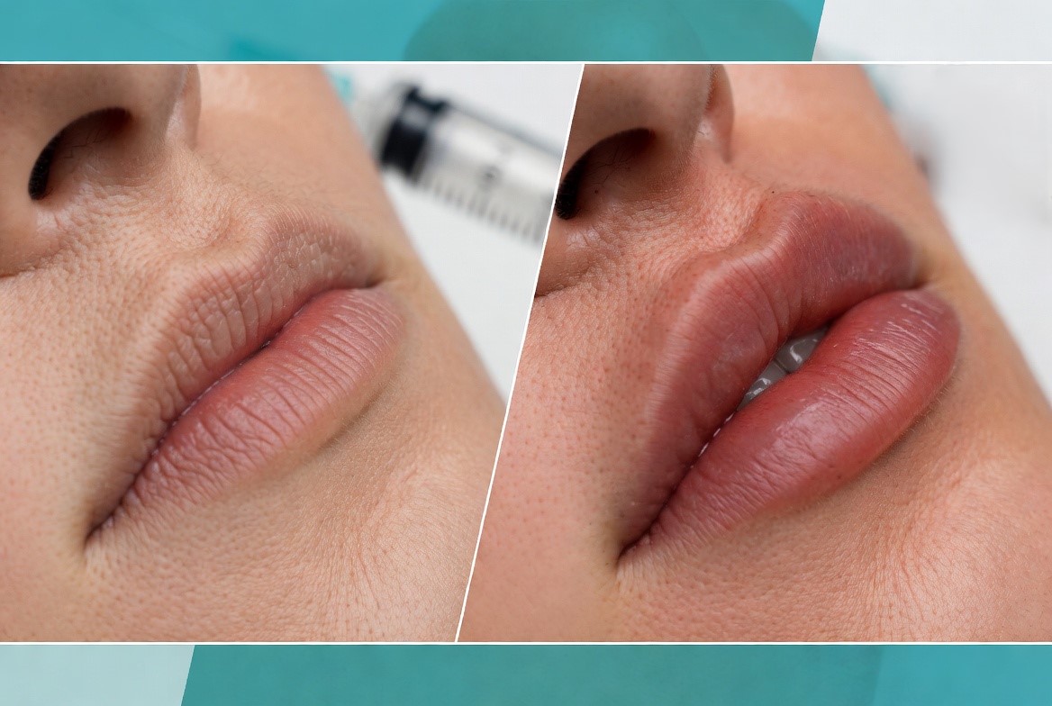 Dr. Valeria Pellegrini | Medicina Estetica & Chirurgia Plastica Monza